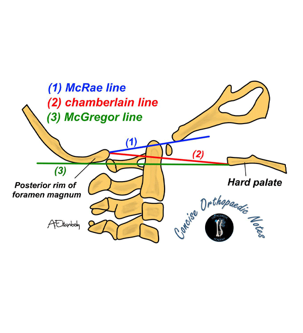 MCQs - Orthopaedic Academy